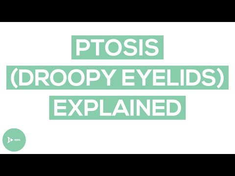 Droopy Eyelids | Eyelid Ptosis Causes and Symptoms