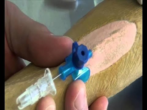 How to place IV line (Drip) in cephalic vein of dog