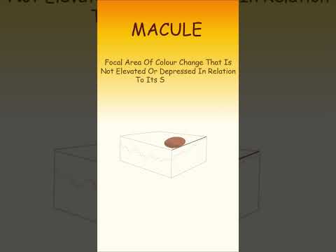 What is Macule, Papule and Nodule? | Common Oral Pathology Terms | Basic Viva Q's | #shorts |