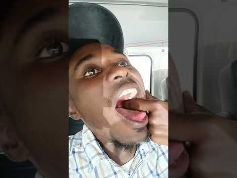 How to remove tonsil stones.