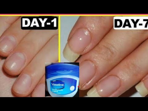 Nail Growth | Nails badhane ke upay | Get strong nails at Home #nails