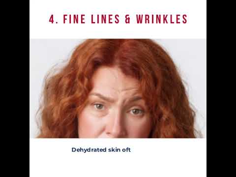 4 signs of dehydrated skin