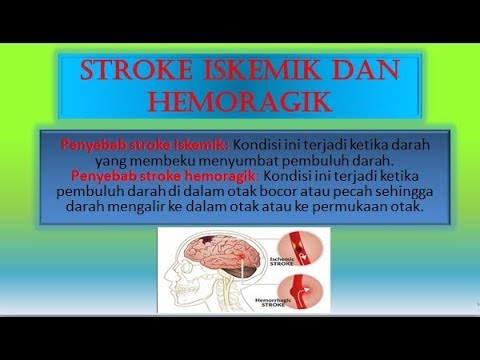 Stroke Iskemik dan Hemoragik
