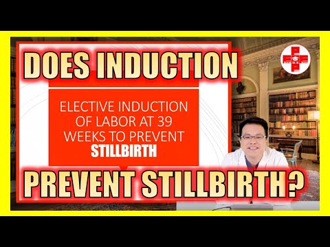 BIRTH PLAN: Induction to Prevent Stillbirth PEEP11
