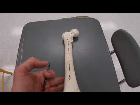 Bone Markings of the Femur_Practice Quiz