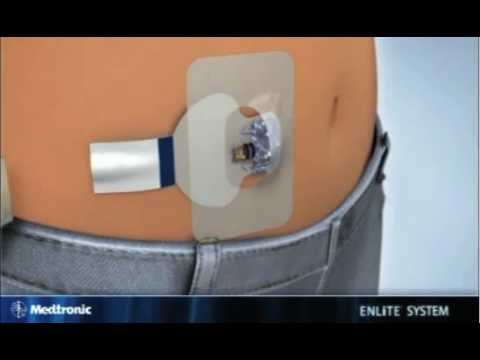 new Glucose Sensor Serter -- MDEA 2013 Gold Winner