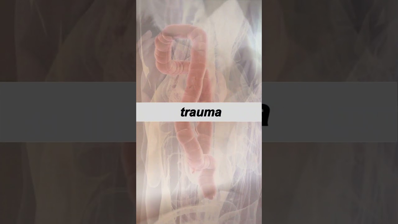 Fever: Paracetamol or NSAID?