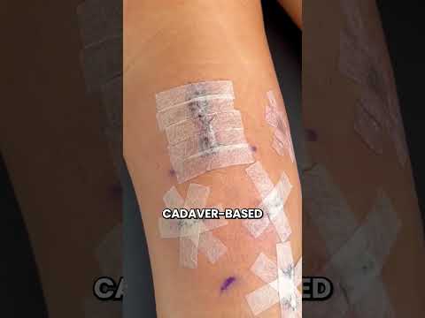 Your Tendon vs. Cadaver Tendon for ACL Repair #how’s shoulder doing? orts