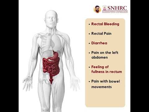Are you Suffering From Proctitis | Let's Check | Gastroenterology Problem | Snhrc | Vellore