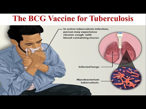 BCG Vaccine: Your Shield Against Tuberculosis