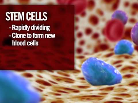 What is "MDS"? (Myelodysplastic Syndromes)