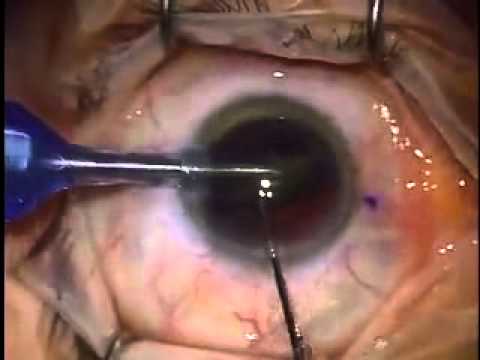 DG 062910 wmv