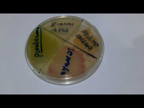 Staphylococcus aureus/Serratia marcescens/ Pseudomonas aeruginosa and Micrococcus Growth on MHA