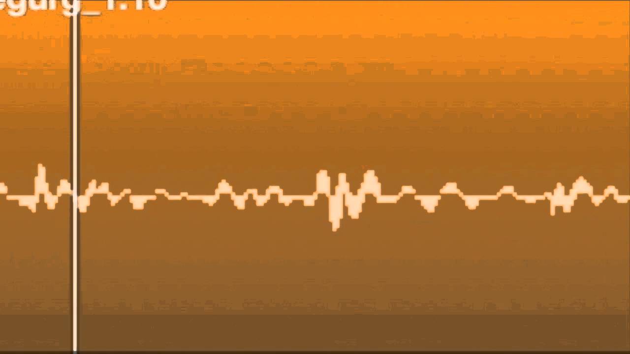 Aortic Regurgitation Murmur Sound