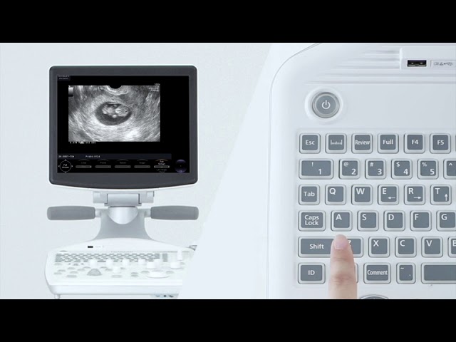 Ultrasound Machine - Fujifilm F37 colored doppler made in japan Trader ...