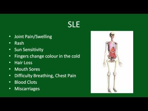 Lupus: A Disease Overview