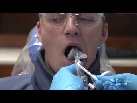 RINN Uni-Grip 360 Anterior Placement | Dentsply Sirona