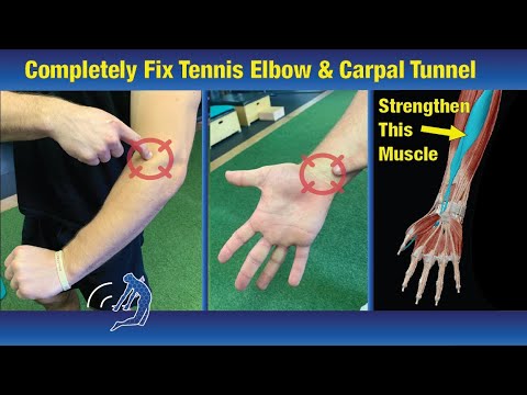 Fix Tennis Elbow in One Week - Exercises that Actually Work!