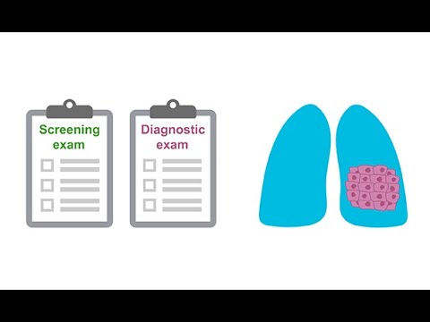 The findings on chest CT that could indicate lung cancer