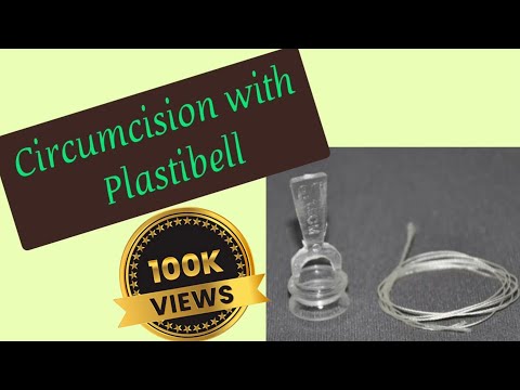 Circumcision Stapler - Circumcision Device Latest Price, Manufacturers ...