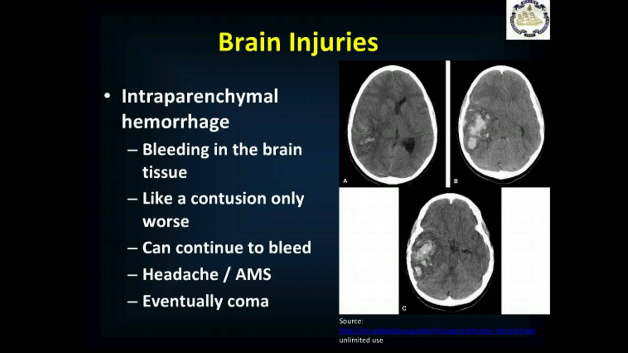 Head and Spinal Injuries