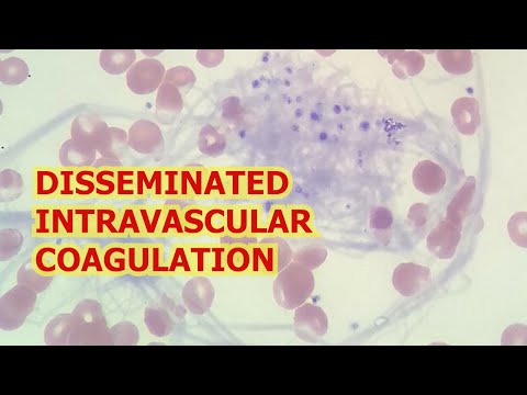 DISSEMINATED INTRAVASCULAR COAGULATION LAB TESTS