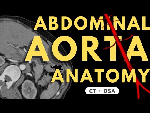 Abdominal Aorta and Branches | Radiology anatomy part 1 prep | How to read CTA + DSA