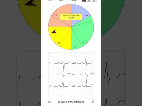 Cardiac axis trainer