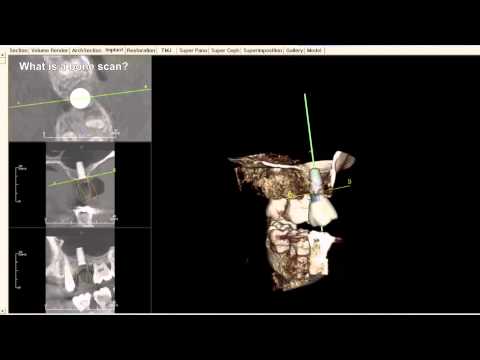 What is a bone scan? | Daniel Daniel Dentistry