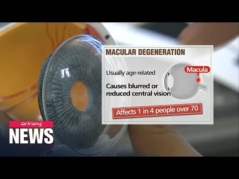 Blurred vision, age-related eye problems require regular check-ups