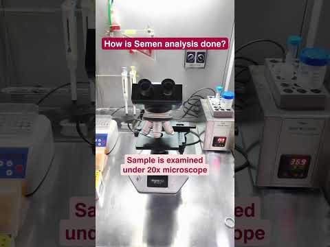 How to read Semen Analysis?