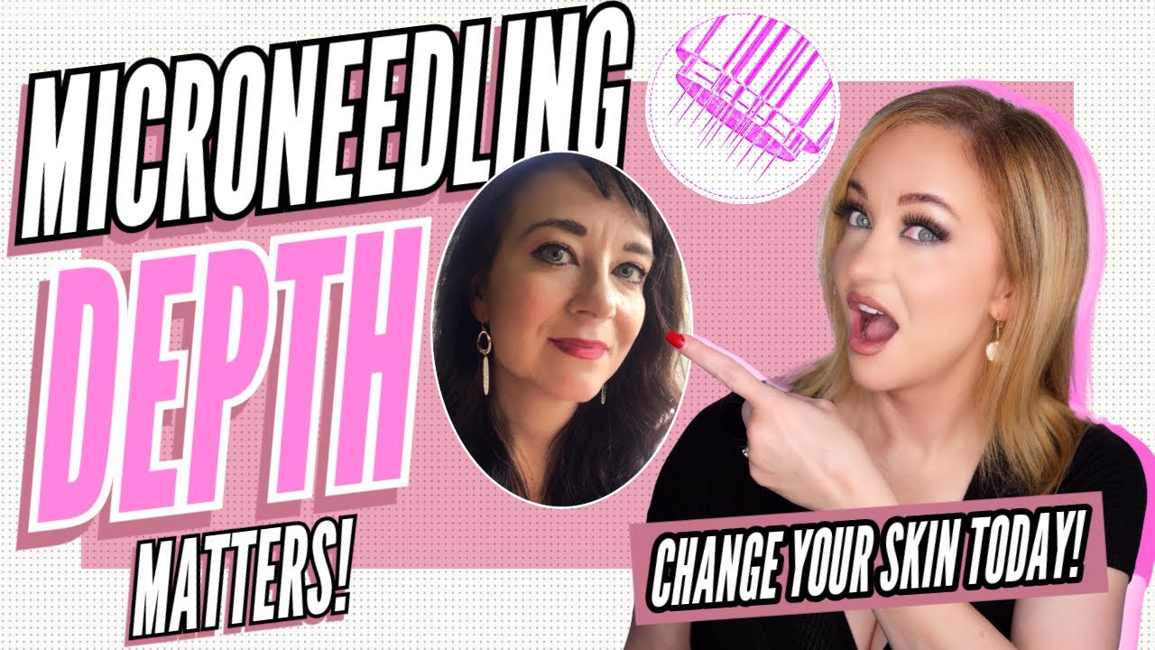 Microneedling Depth Guide: The Exact Needle Lengths I Use at 48 for Every Face Zone