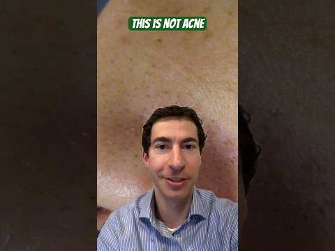 Why those blackheads on your nose aren't acne and how to treat - #dermatologist explains #shorts