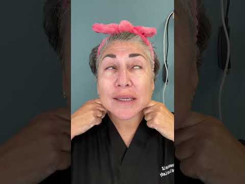 #Lymphatic drainage for double chin