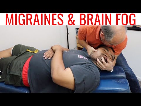 Migraines, Brain Fog & Anxiety cripple 32 year old treated by Chiropractor