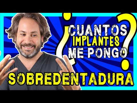 💰Cuantos IMPLANTES son necesarios para una DENTADURA COMPLETA? 👉Sobredentadura con 2 o 4 IMPLANTES