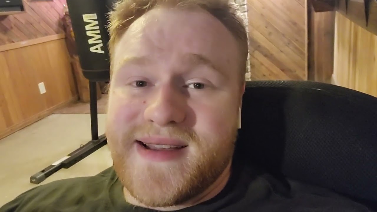 how to survive being ginger!!!