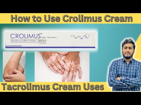 Crolimus (Tacrolimus) Cream Uses-Side Effects-Precautions #Tacrolimuscream