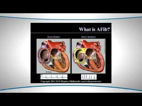 What do I need to know about Atrial Fibrillation?