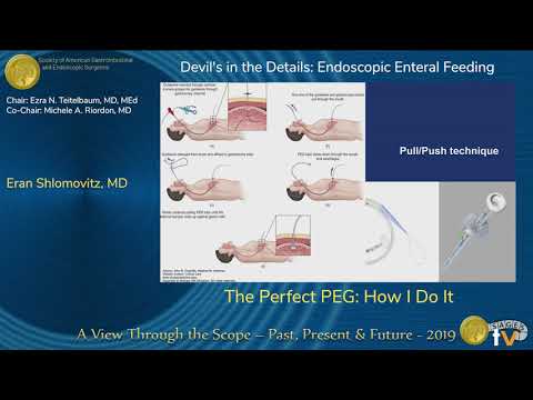 The Perfect PEG: How I Do It