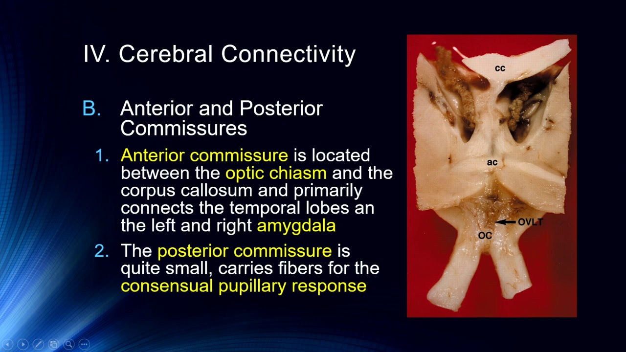 Lecture #18 Hemispheric Specialization  Myth Busting & Anatomical Differences