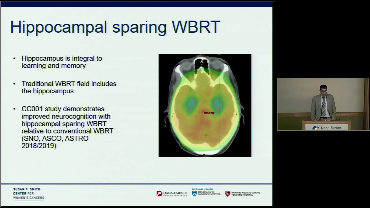 Study of Whole-Brain Radiation vs. Stereotactic Radiation for Patients with 5-20 Brain Metastases