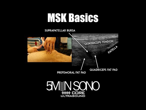 5 Minute Sono - MSK Basics