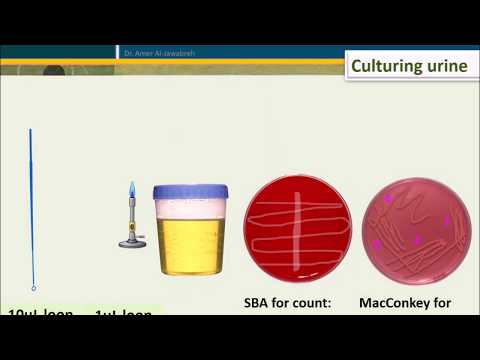 Urine Culture: How To Interpret Count