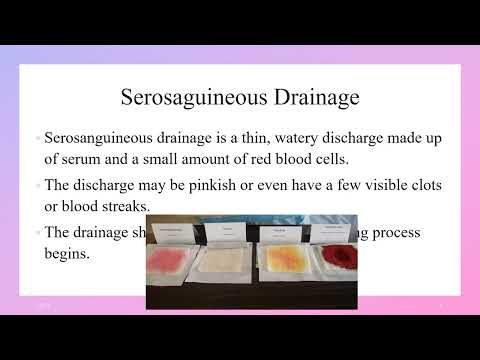 TYPES OF DRAINAGE
