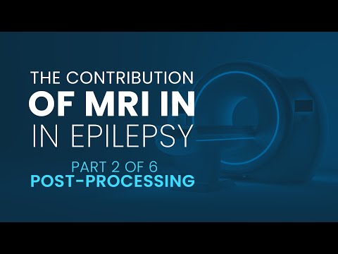 The contribution of MRI in Epilepsy | Part 2 Post-Processing