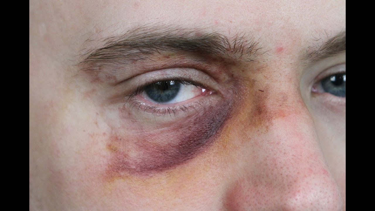 Black Eye Makeup: SFX Beginner's Tutorial