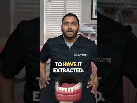 Tooth Be Gone? Implants to the Rescue! | Dr. Patel at The Tooth Experience