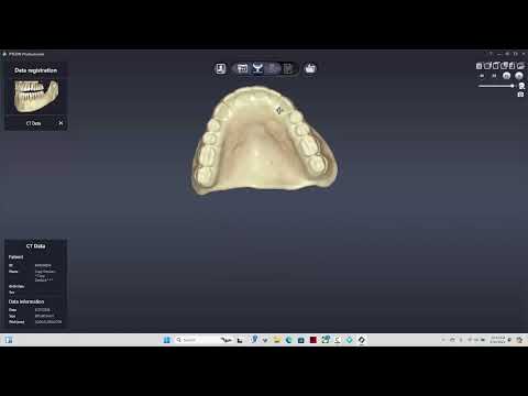 Copy Dentures in your CBCT!