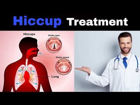 Hiccup treatment Urdu//Hindi by saeed pharma ہمیں ہچکیاں کیوں آتی ہے